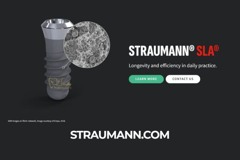 Tất tần tật về trụ Implant Straumann Thụy Sĩ (P2) - Mysmileclinic